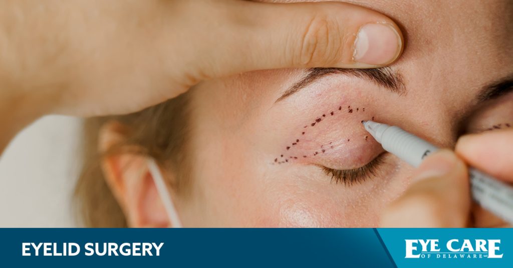Eyelid Surgery Wilmington | Blepharoplasty Dover