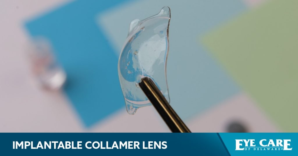 Newark Implantable Collamer Lens (ICL) Surgery – Eye Care of Delaware