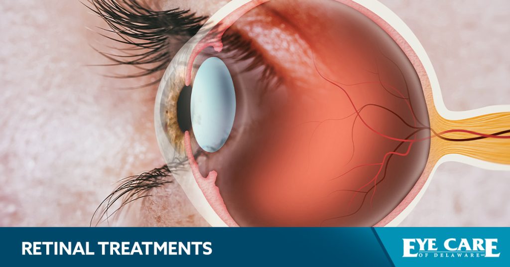 Retina Specialist Dover | Retina Specialist Wilmington